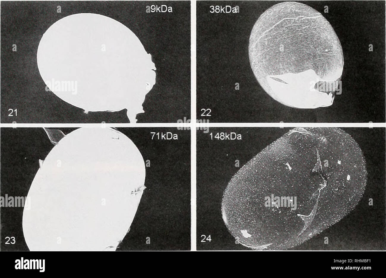 Dextrans hi-res stock photography and images - Alamy