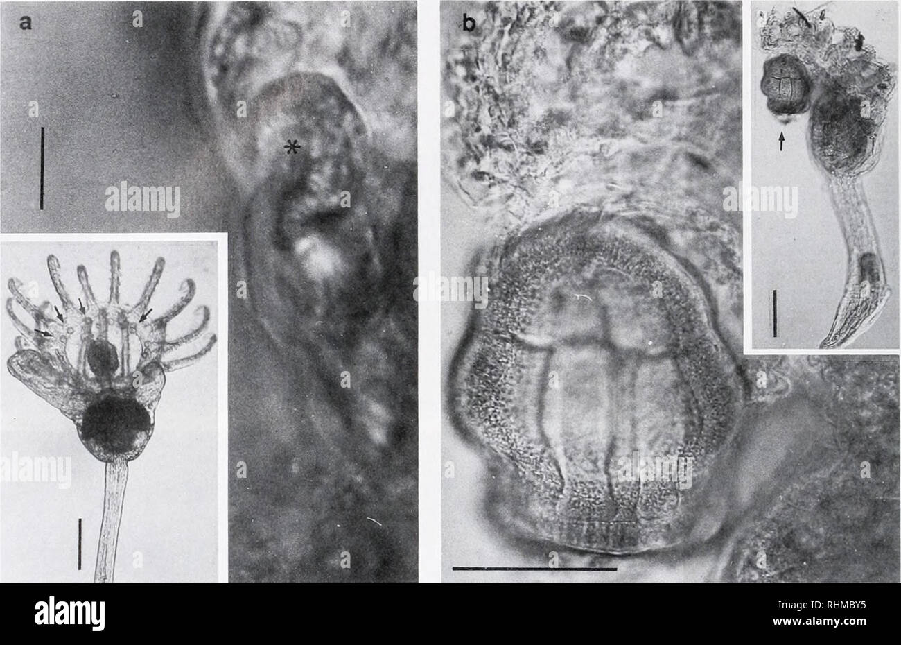 Pregnant Mucus Plug Microscope