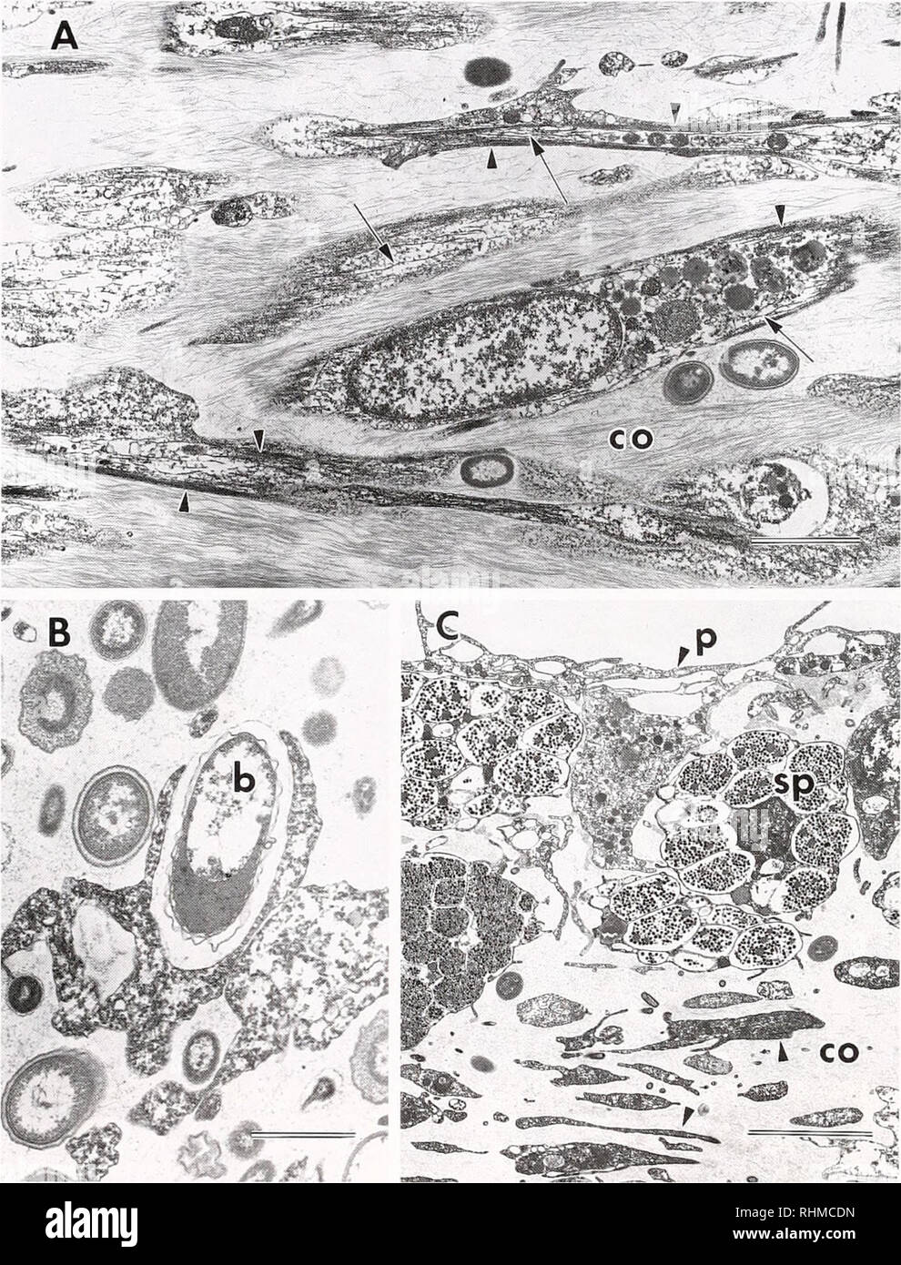 Transmission electron microscopy cells hi-res stock photography and ...