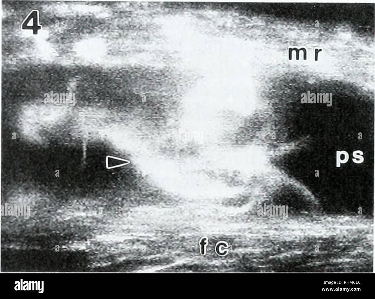 Periciliary hi-res stock photography and images - Alamy