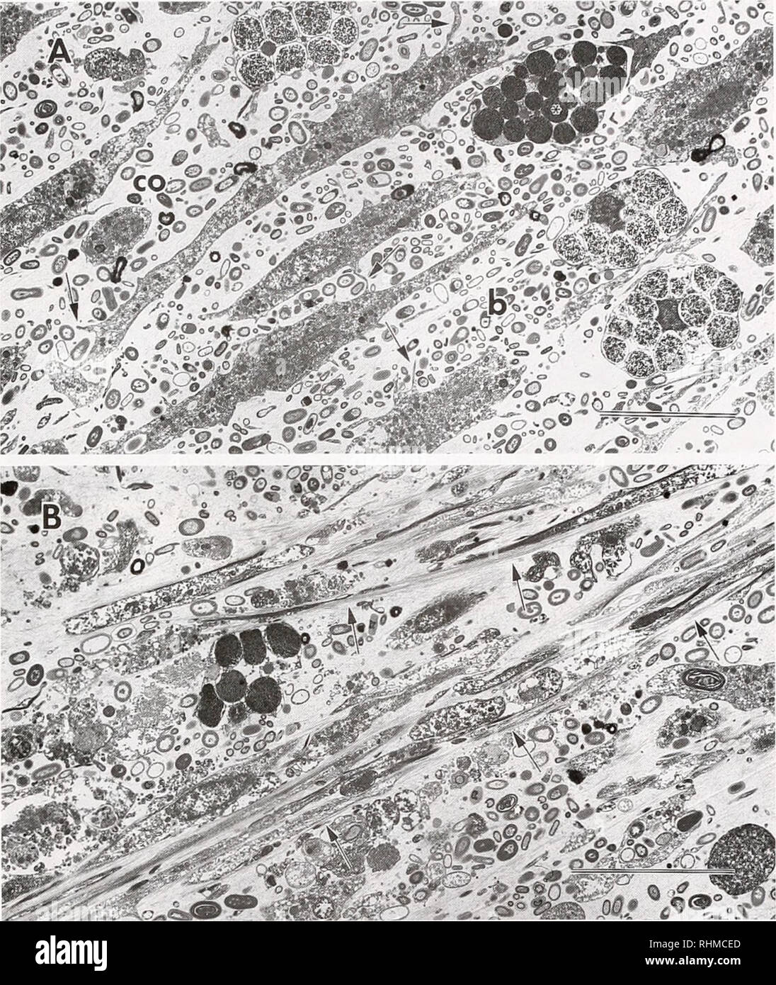 Transmission electron microscopy cells hi-res stock photography and ...