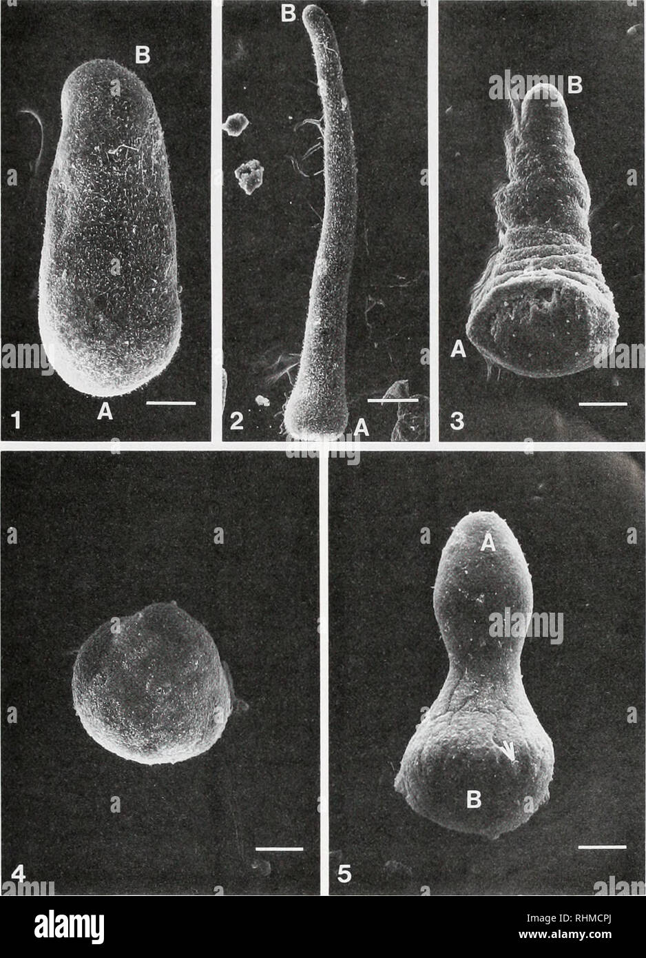 Planula larva hi-res stock photography and images - Alamy