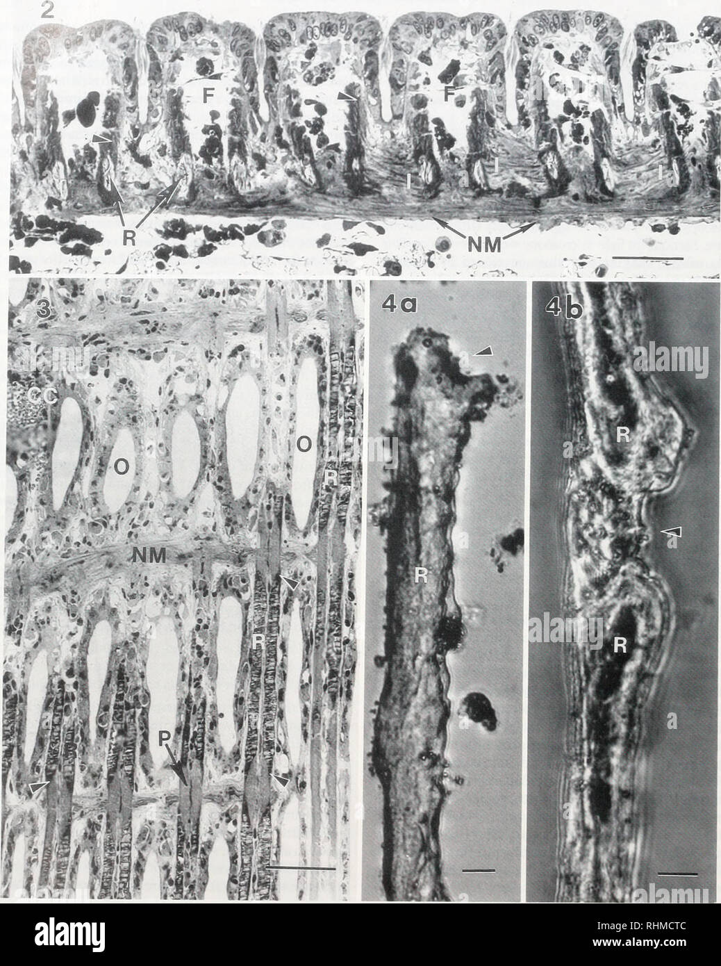 Muscle fibers micrograph hi-res stock photography and images - Alamy