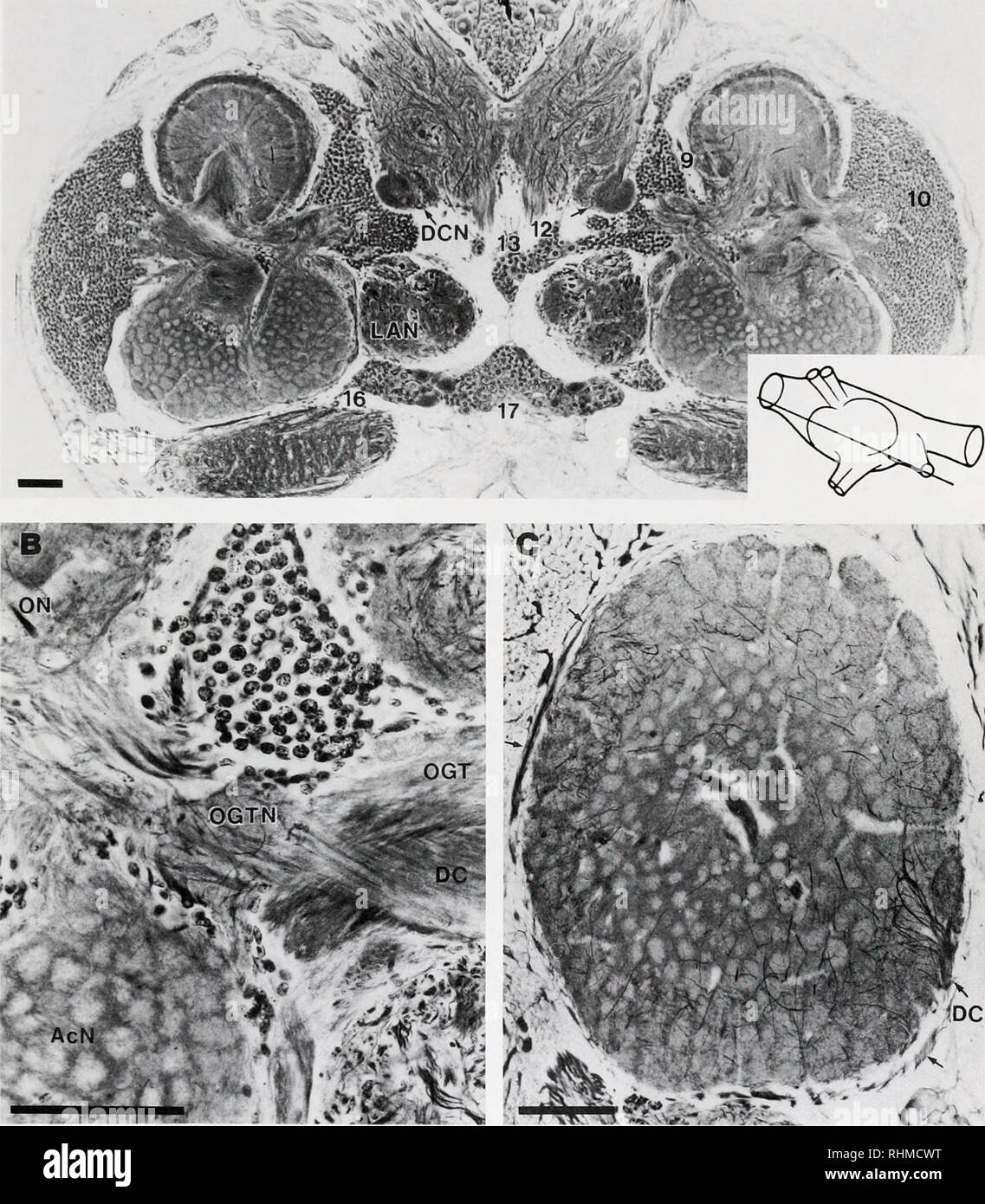 Medial section of brain hi-res stock photography and images - Alamy