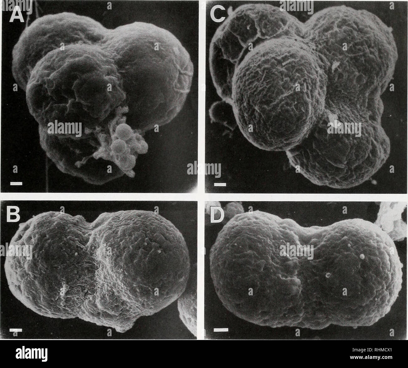 Epoxy embedded tissue hi-res stock photography and images - Alamy