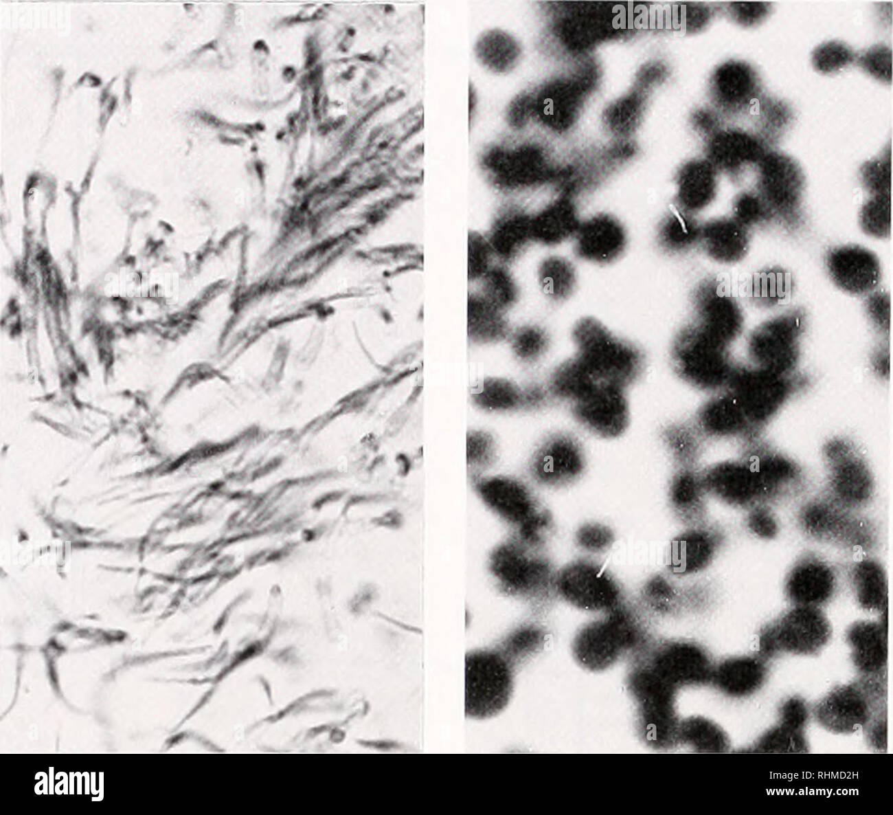 Light micrograph of sperm hi-res stock photography and images - Alamy