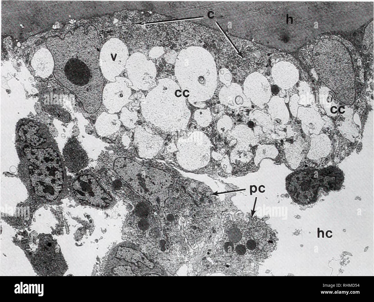 H ferritin hi-res stock photography and images - Alamy