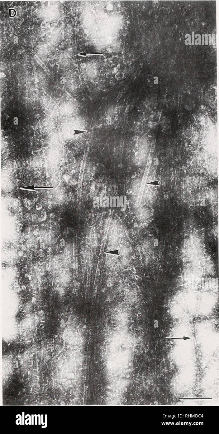 Axoplasm hi-res stock photography and images - Alamy