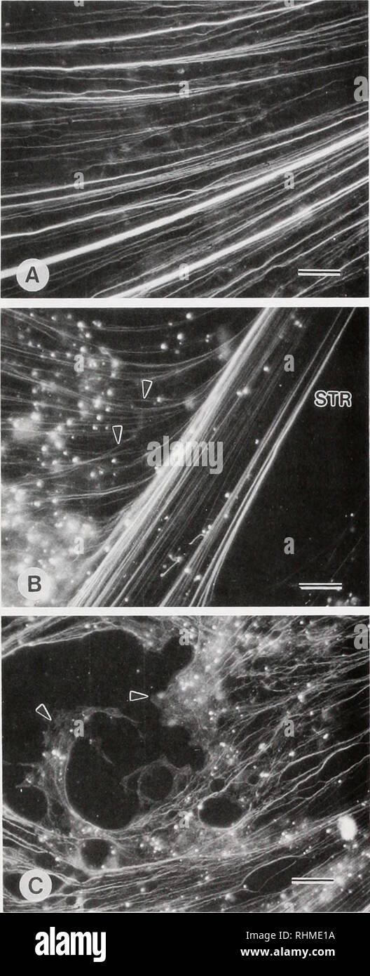 Immunofluorescence microtubules hi-res stock photography and images - Alamy