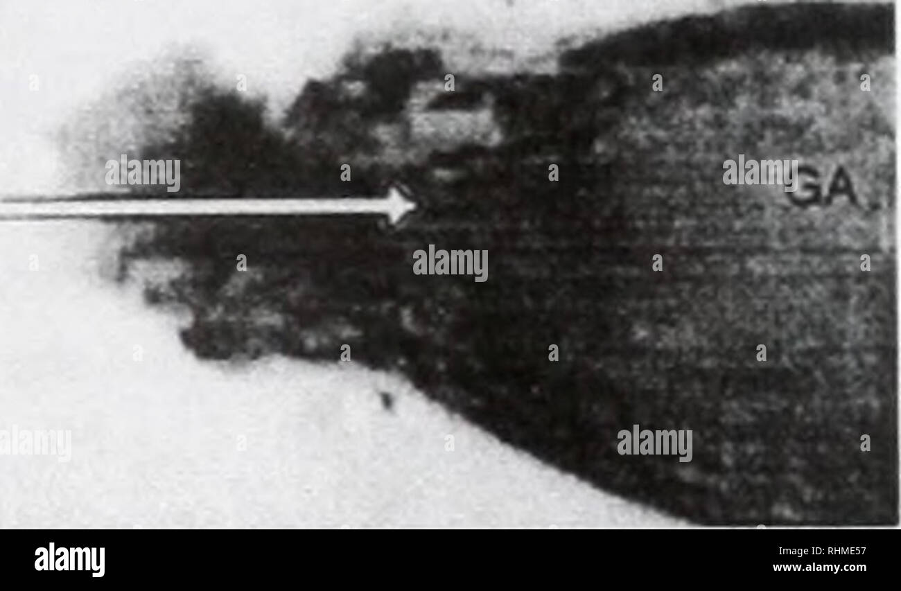 Giant axon hi-res stock photography and images - Alamy