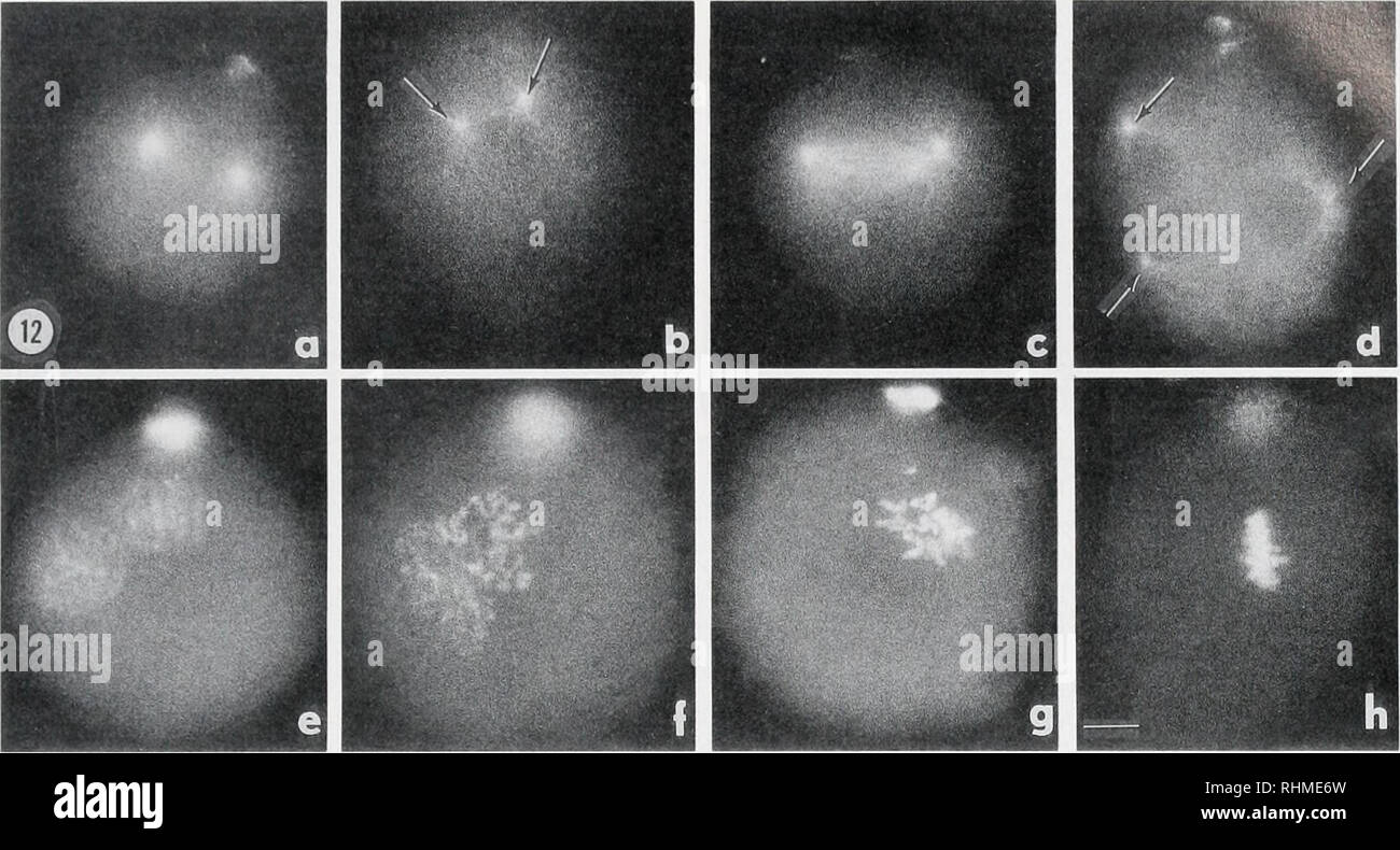 Pronuclear stages hi-res stock photography and images - Alamy