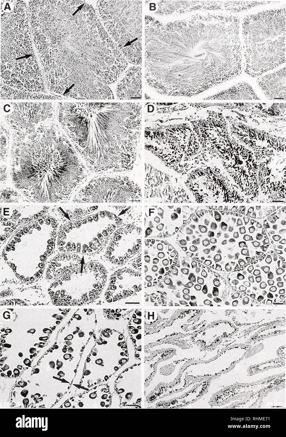 Alveolar sections hi-res stock photography and images - Alamy