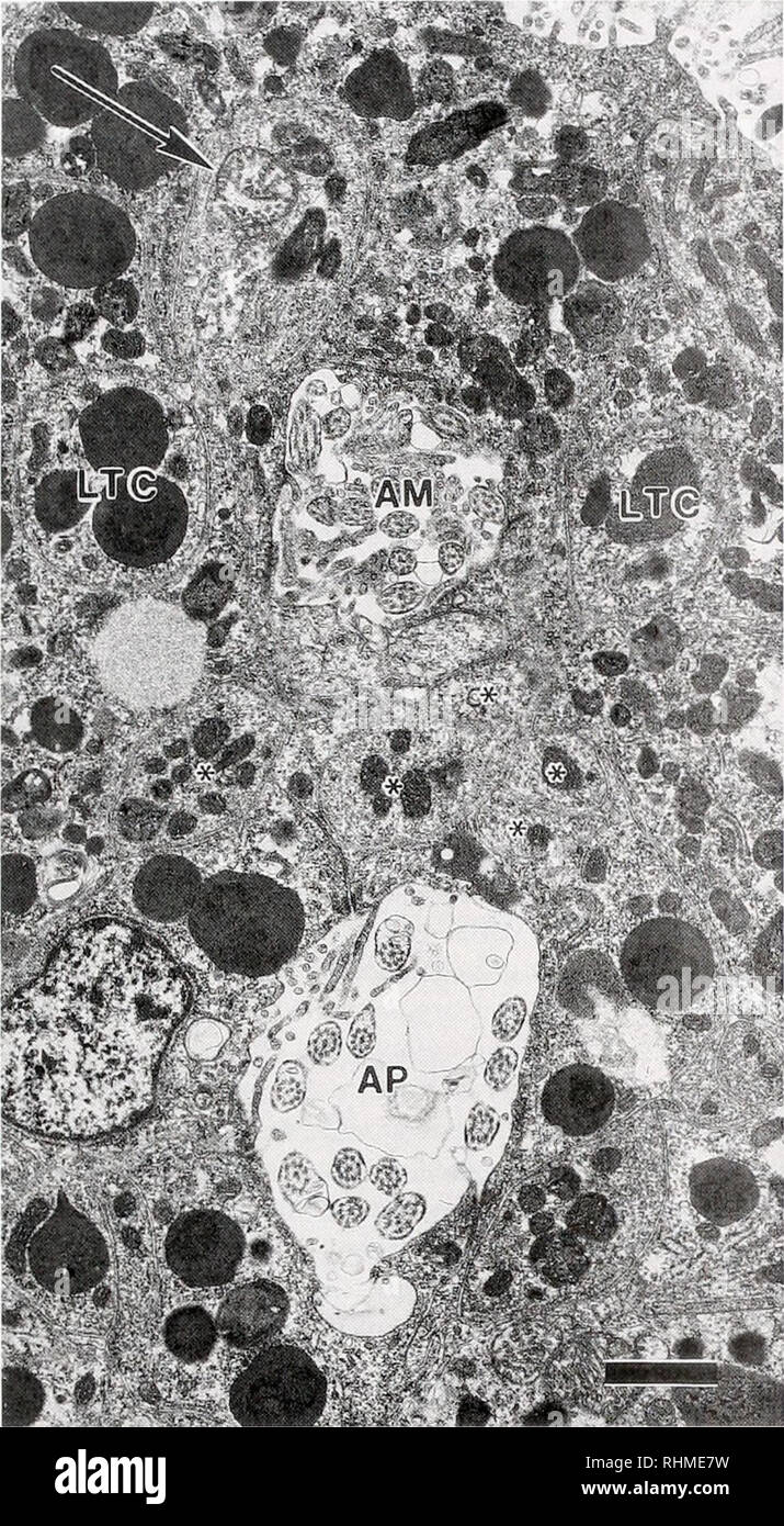 Dendritic cell micrograph hi-res stock photography and images - Alamy