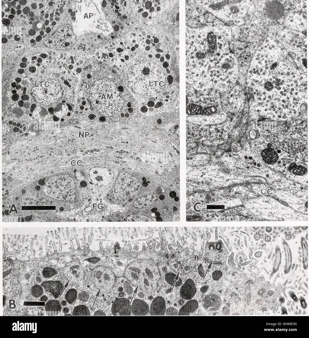Electron micrograph neuron hi-res stock photography and images - Alamy