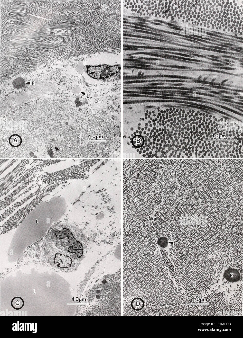 Collagen fibers electron micrograph hi-res stock photography and images ...