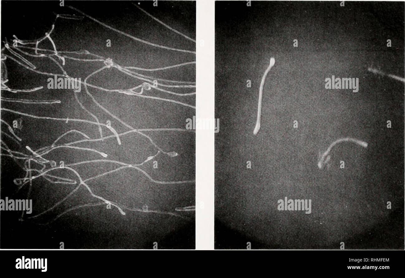 Cilia electron micrograph hi-res stock photography and images - Alamy