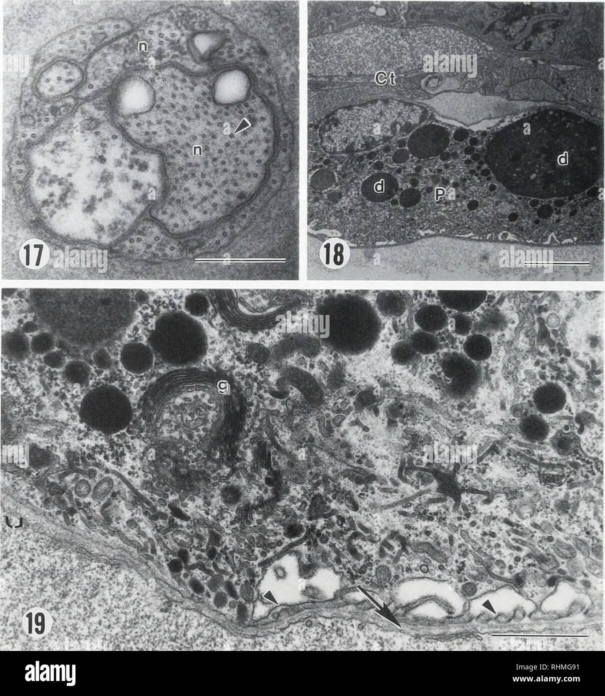 Cytoplasm tem hi-res stock photography and images - Alamy