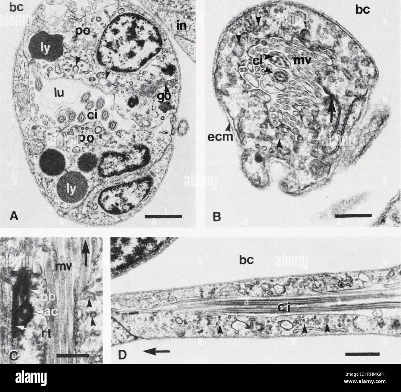 Podocytes hi-res stock photography and images - Alamy