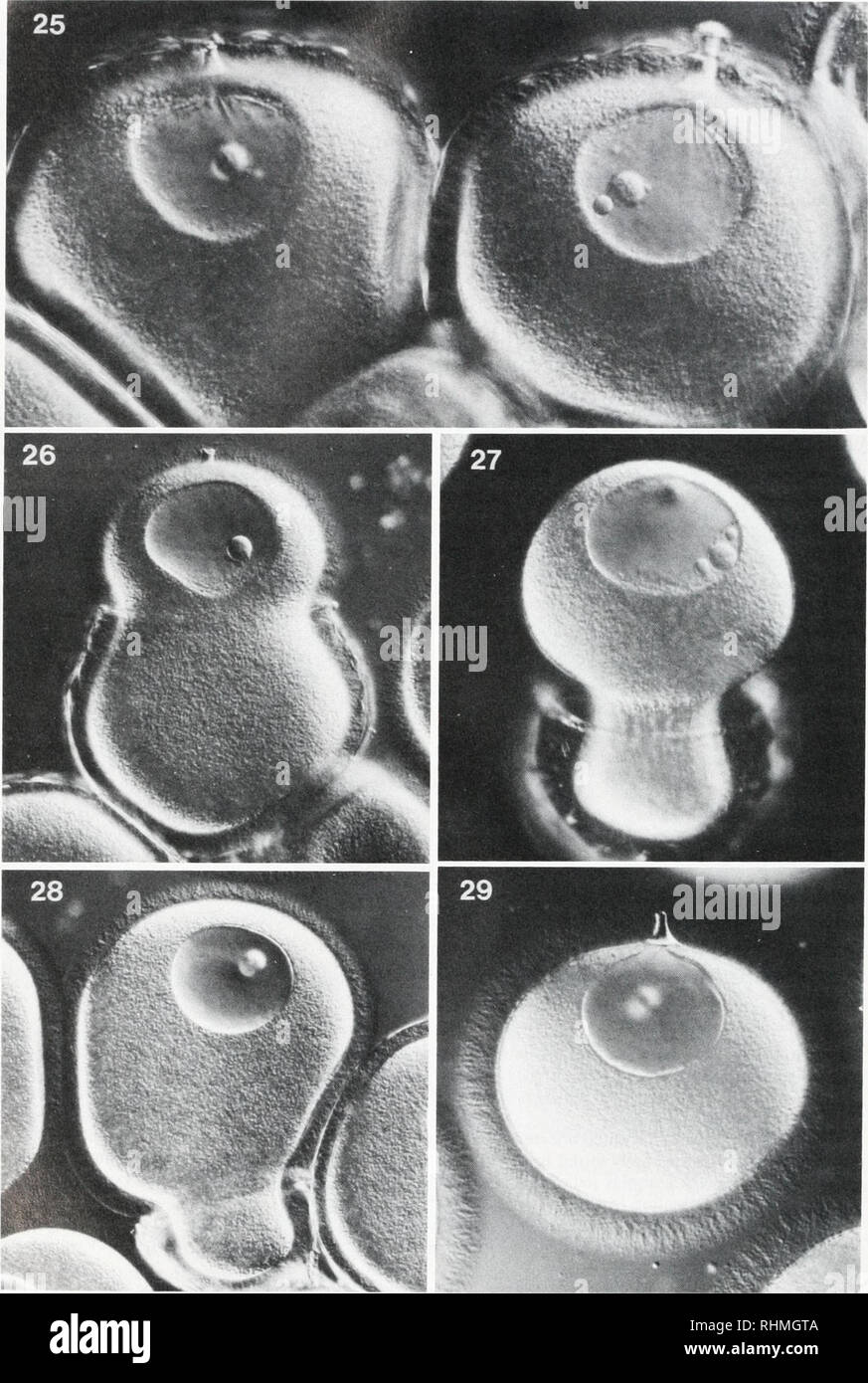 Ovulation micrograph hi-res stock photography and images - Alamy