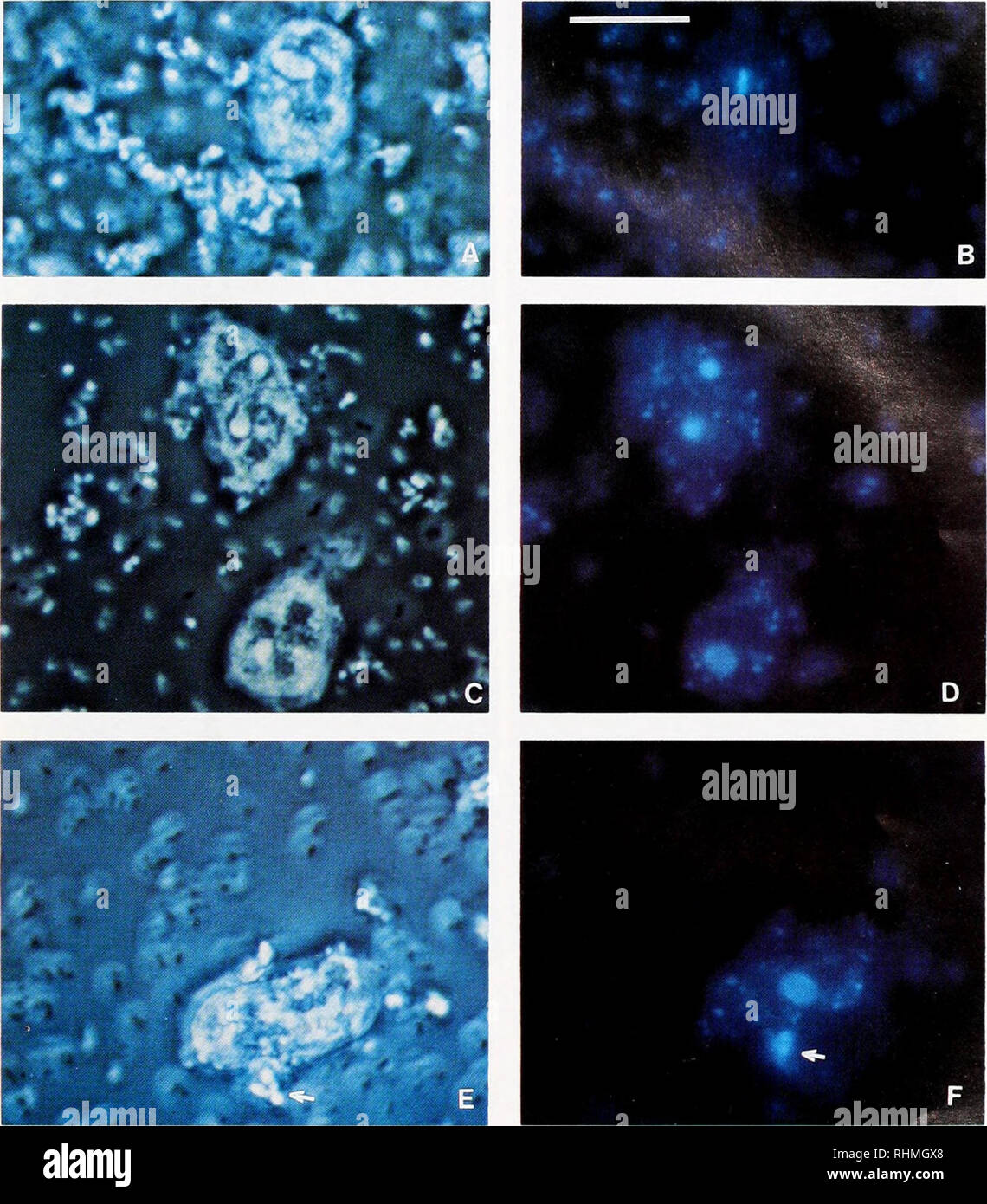 Metaphase, fluorescence micrograph hi-res stock photography and images ...