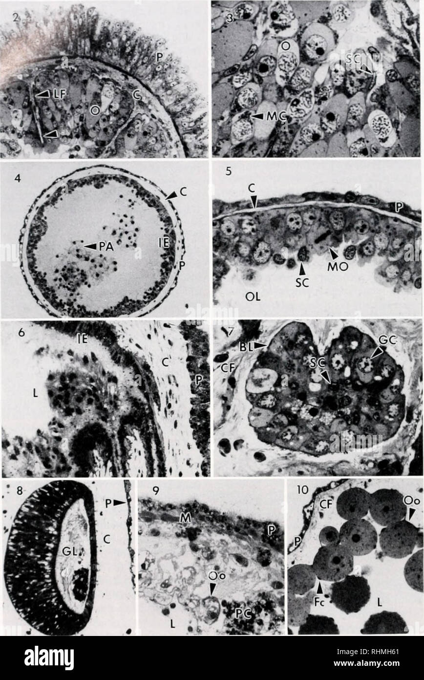 Connective tissue light micrograph hi-res stock photography and images ...