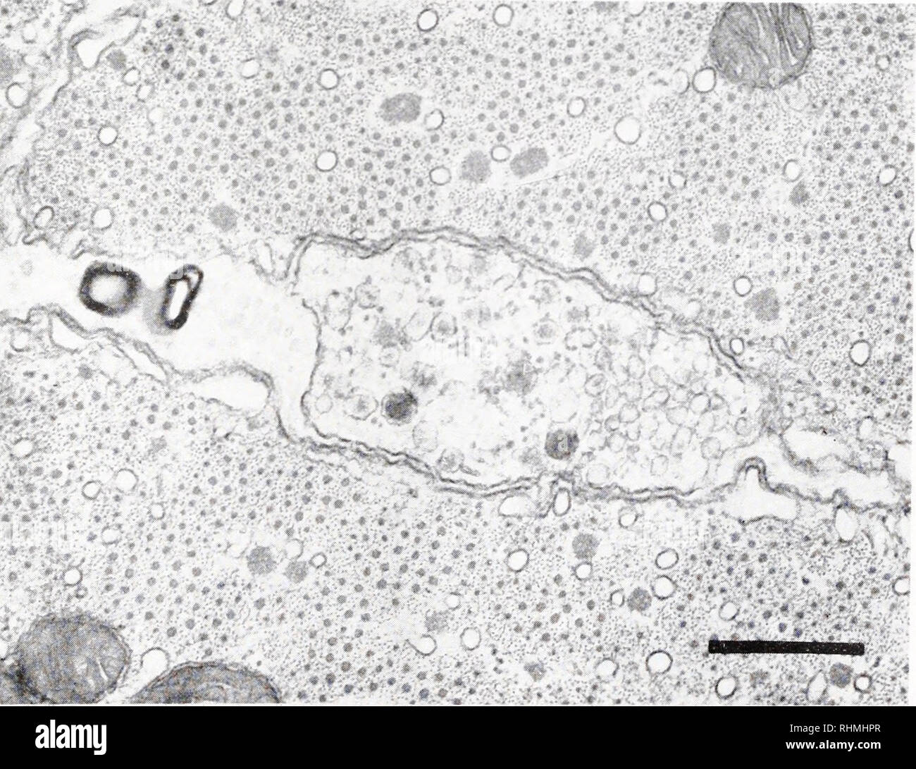 Trunk cross section micrograph hi-res stock photography and images - Alamy