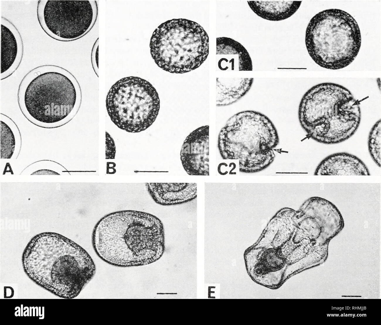 Starfish Egg Development Frontiers | Larval Development Of Holothuria