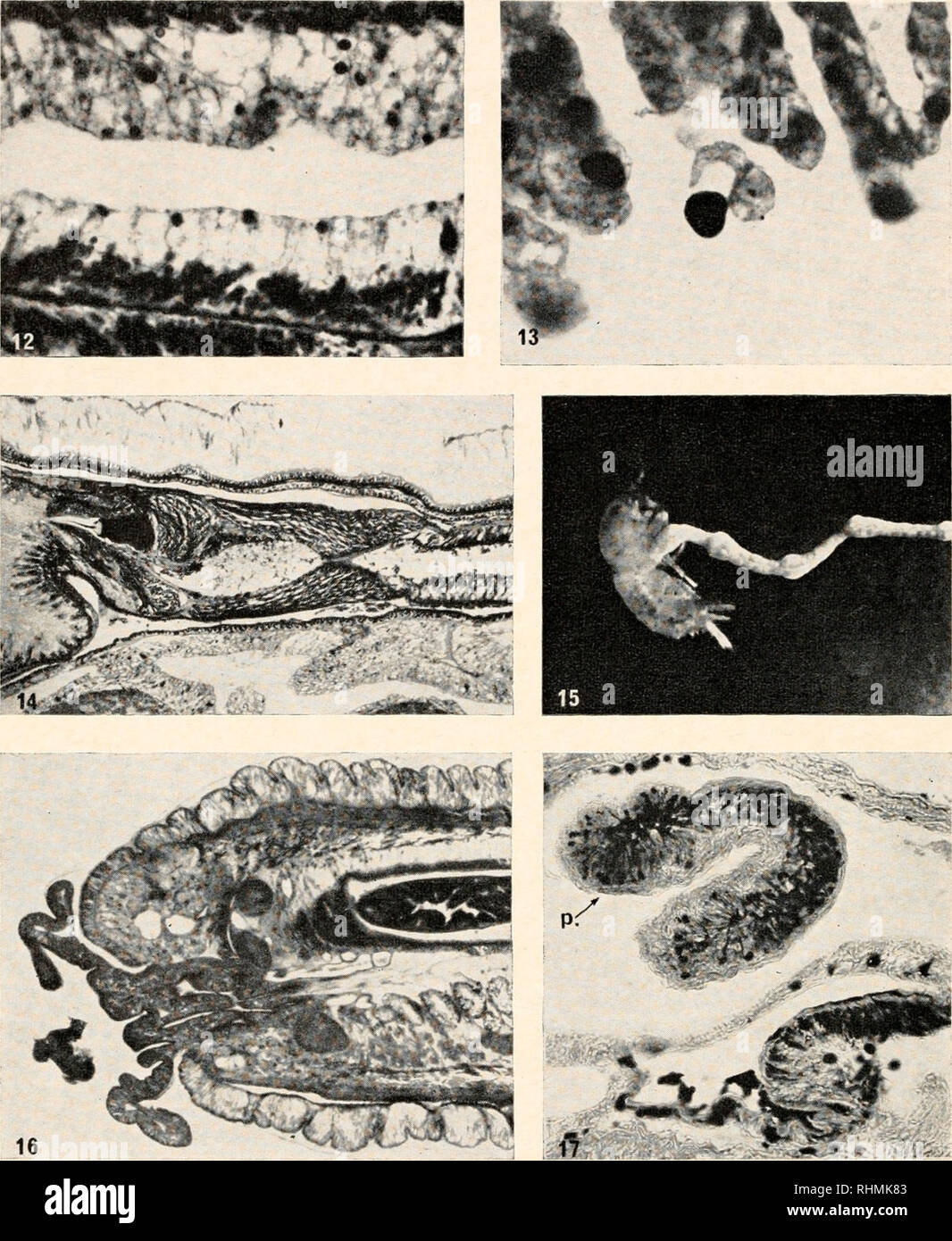 Gastrodermis hi-res stock photography and images - Alamy