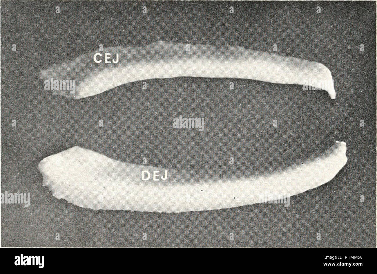 200 Microns High Resolution Stock Photography and Images - Alamy