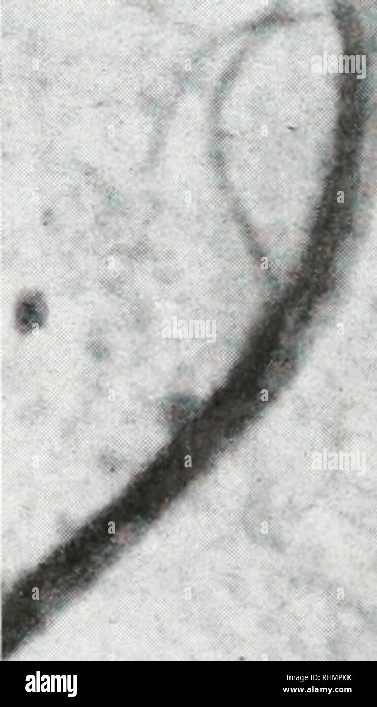 Cilia electron micrograph hi-res stock photography and images - Alamy