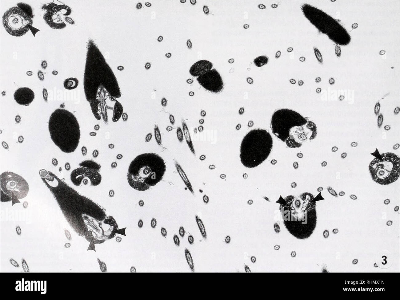 Plasma membrane micrograph hi-res stock photography and images - Alamy