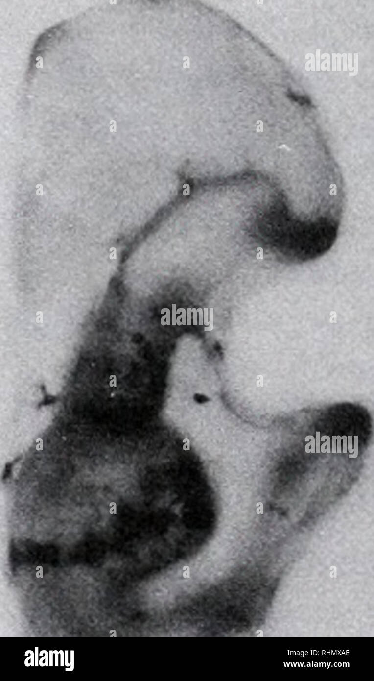 32 cell stage hi-res stock photography and images - Alamy