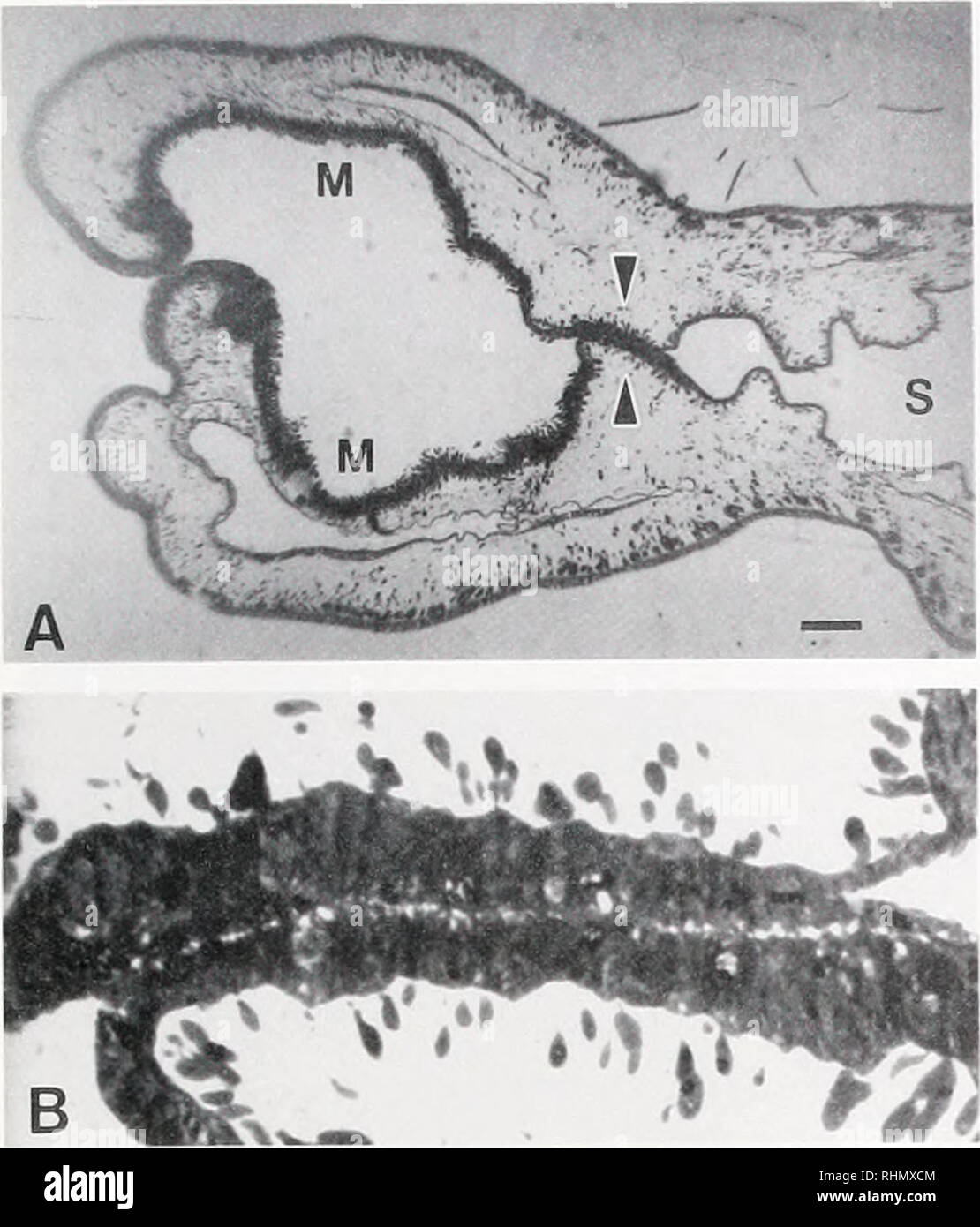 Beroe sp hi-res stock photography and images - Alamy