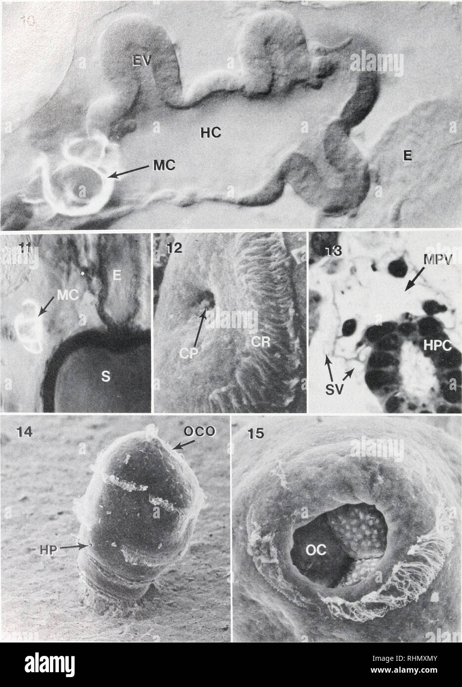 Differential interference contrast micrograph hi-res stock photography ...