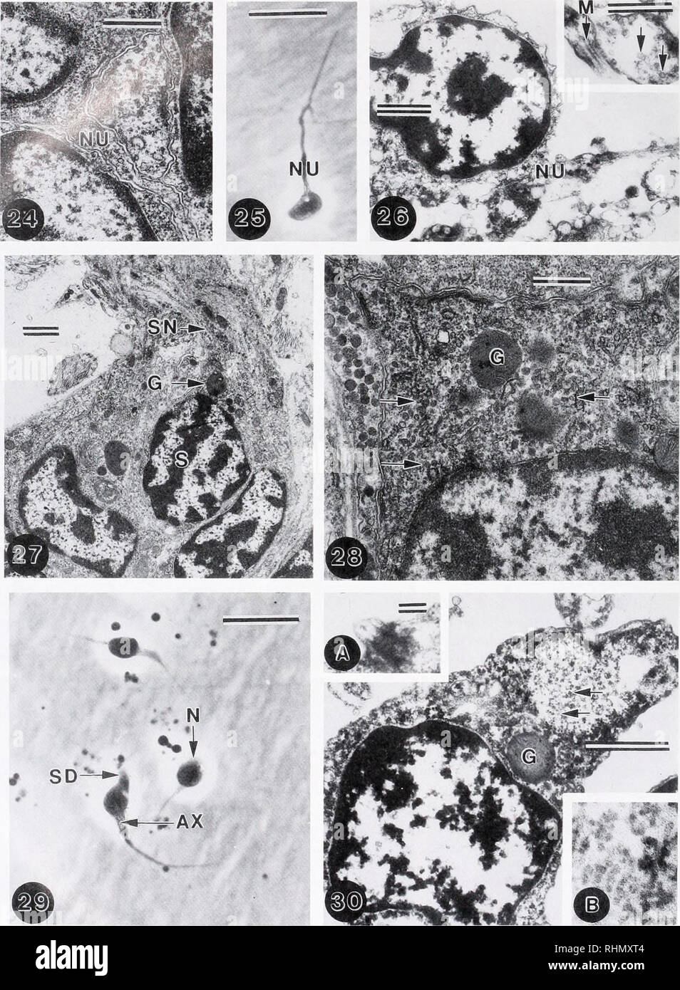Interneuron High Resolution Stock Photography and Images - Alamy