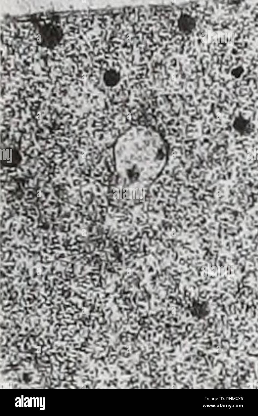 Egg cell micrograph hi-res stock photography and images - Alamy