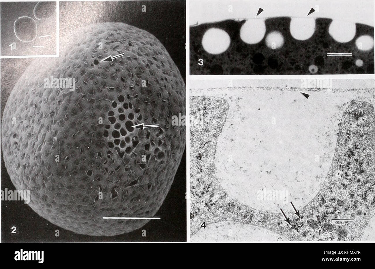 Plasma membrane micrograph hi-res stock photography and images - Alamy