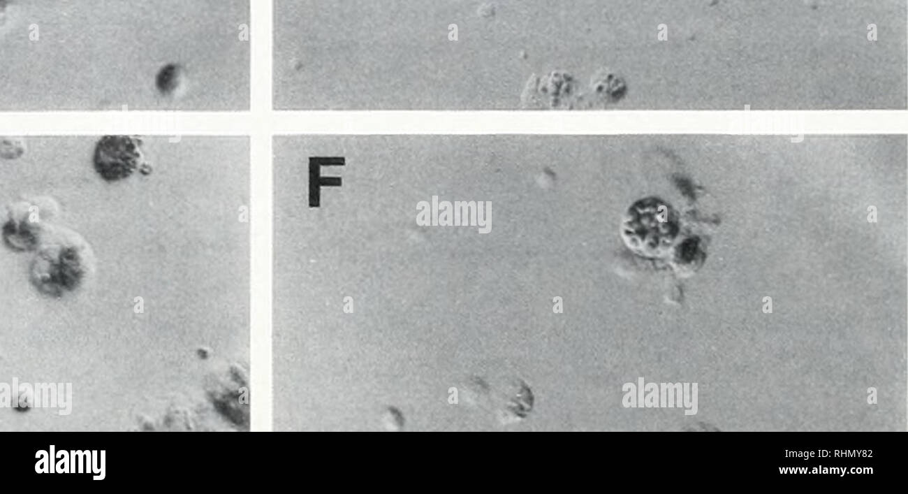 400x magnification hi-res stock photography and images - Alamy