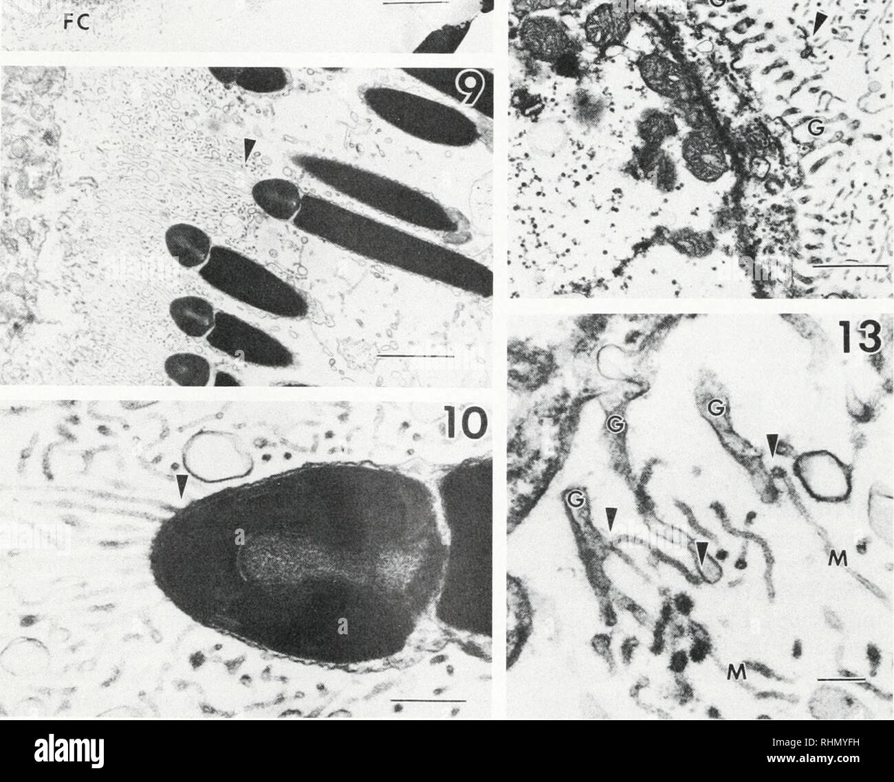 Cilia electron micrograph hi-res stock photography and images - Alamy