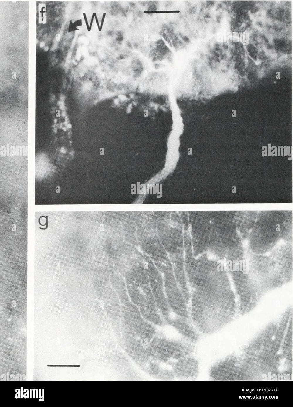 Midline swelling hi-res stock photography and images - Alamy