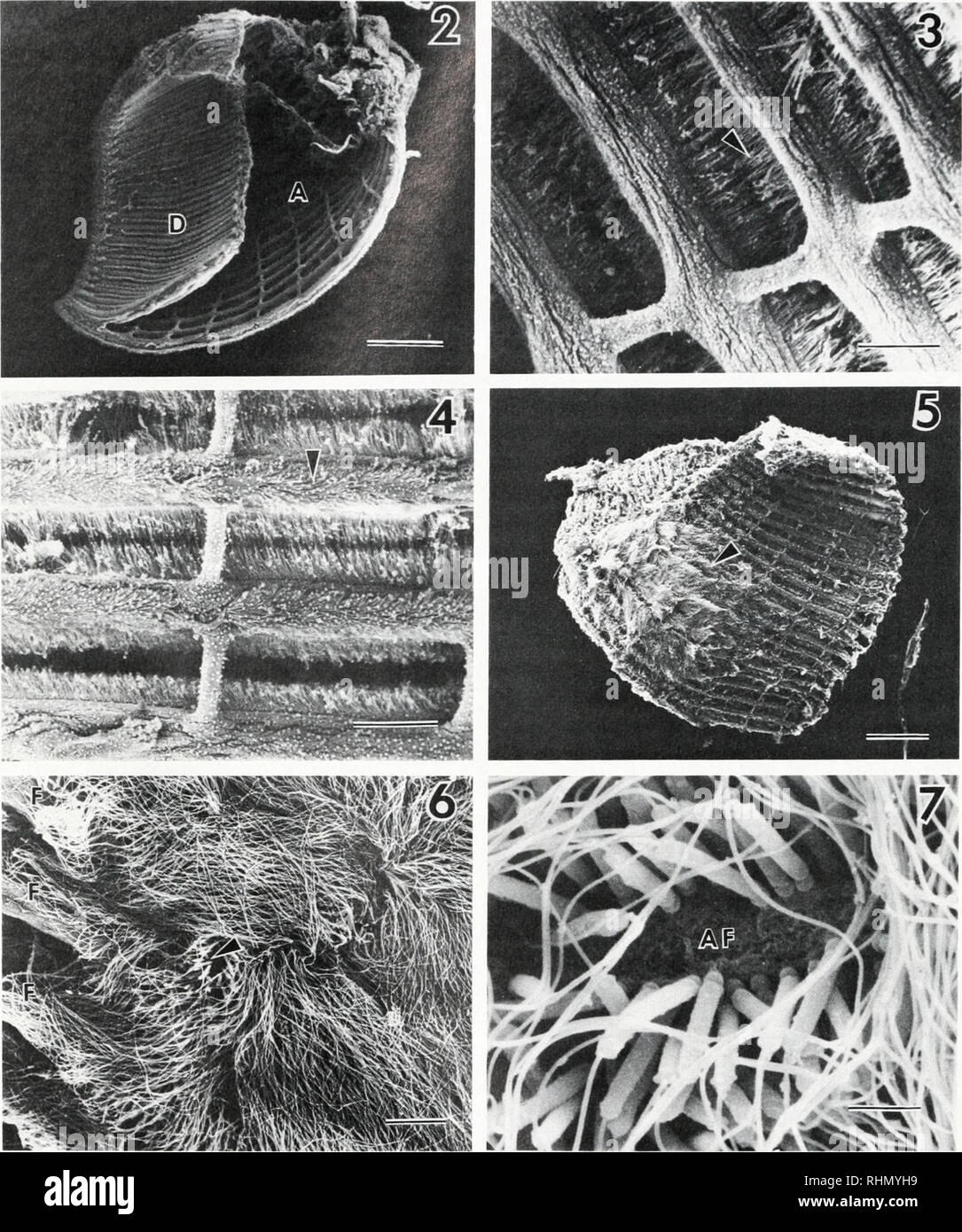 Cilia electron micrograph hi-res stock photography and images - Alamy