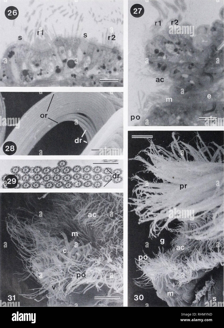 Ciliary bands hi-res stock photography and images - Alamy