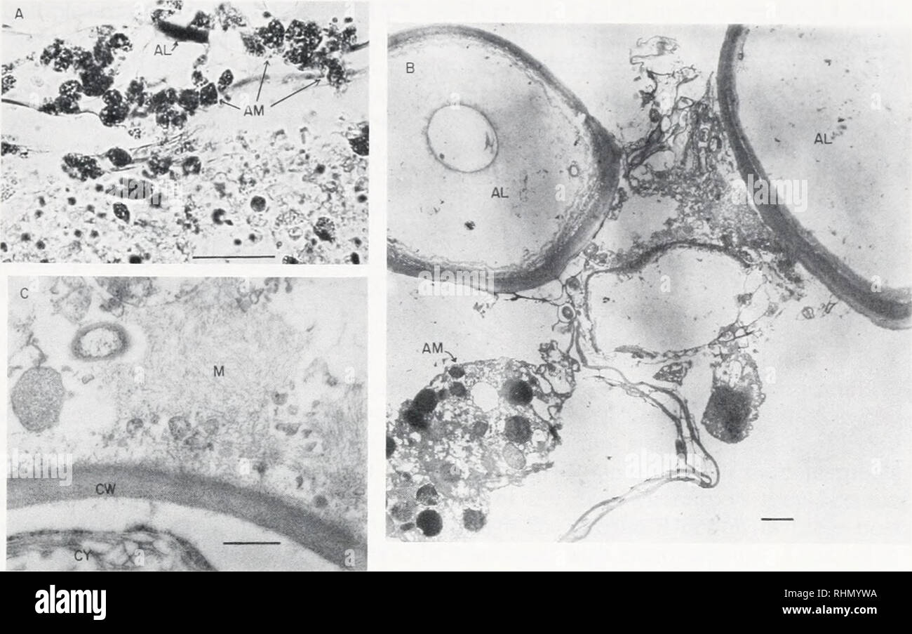 Chloroplast cell micrograph hi-res stock photography and images - Alamy