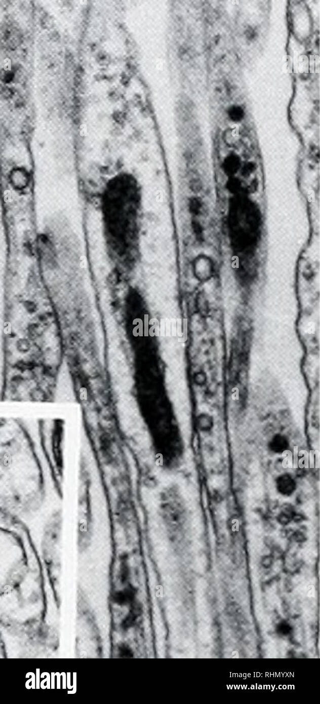 Ciliated cells micrograph hi-res stock photography and images - Alamy