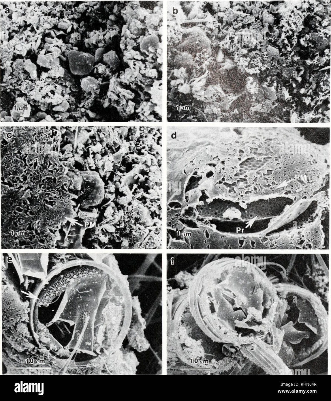 Prorocentrum sp hi-res stock photography and images - Alamy