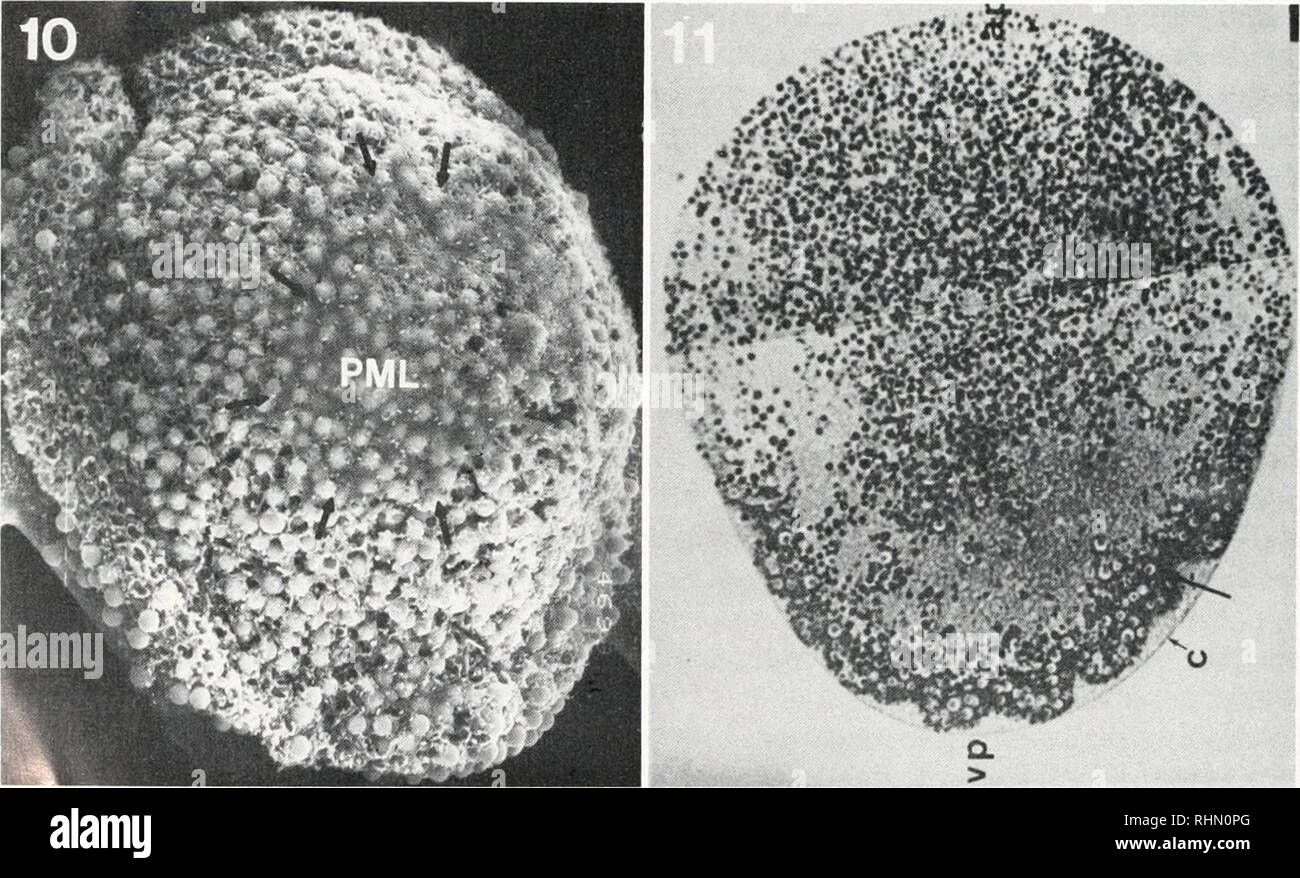Microfilaments Electron Microscopy