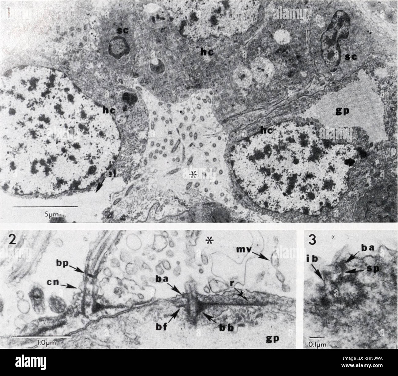 Cilia electron micrograph hi-res stock photography and images - Alamy