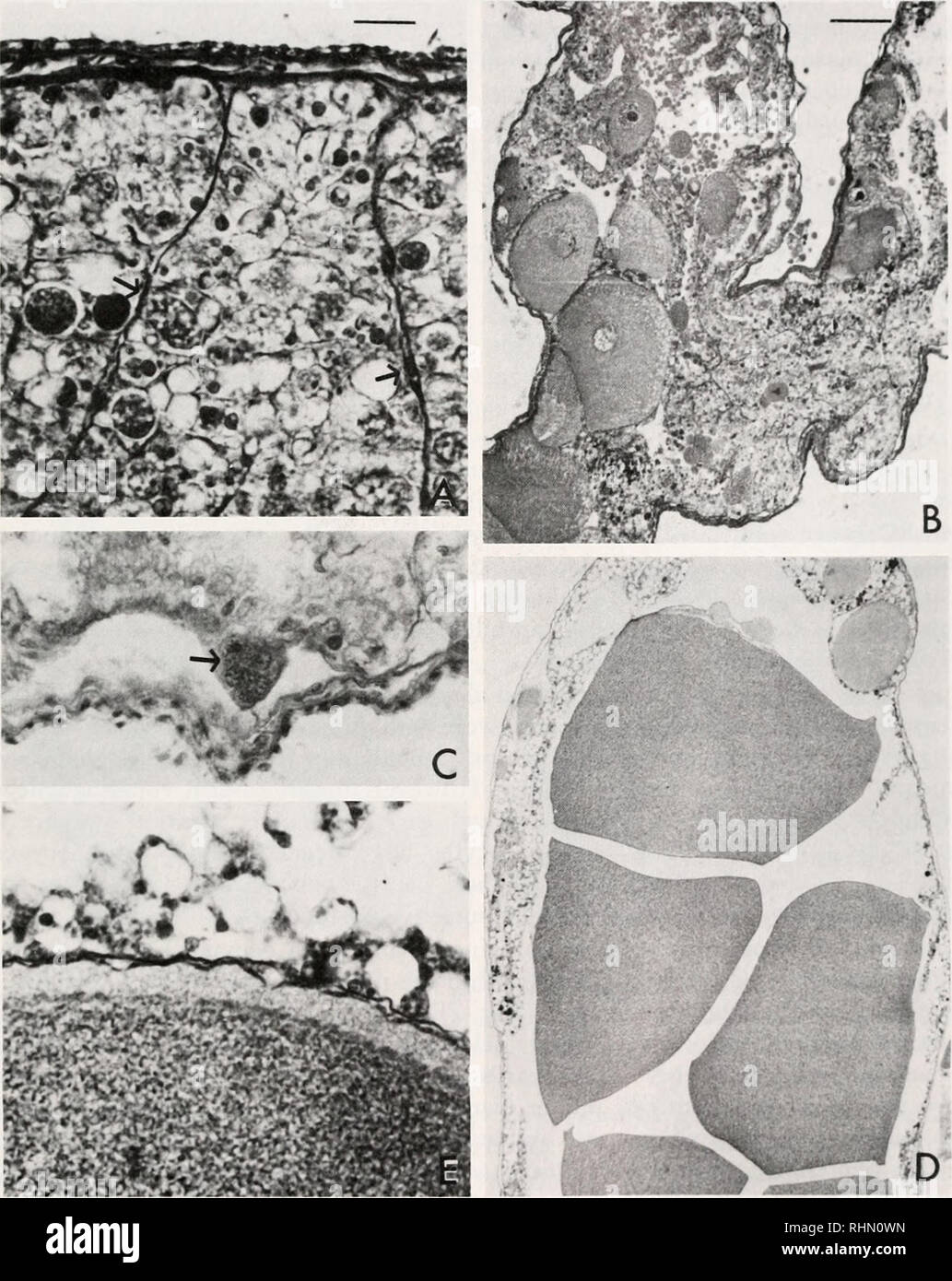 Acinus cells hi-res stock photography and images - Alamy
