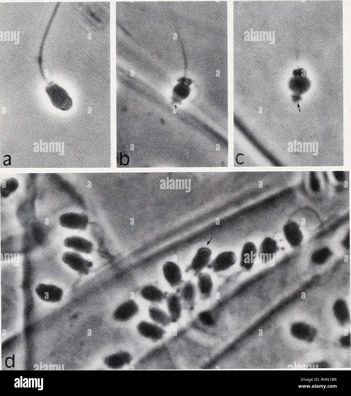 Chorions hi-res stock photography and images - Alamy