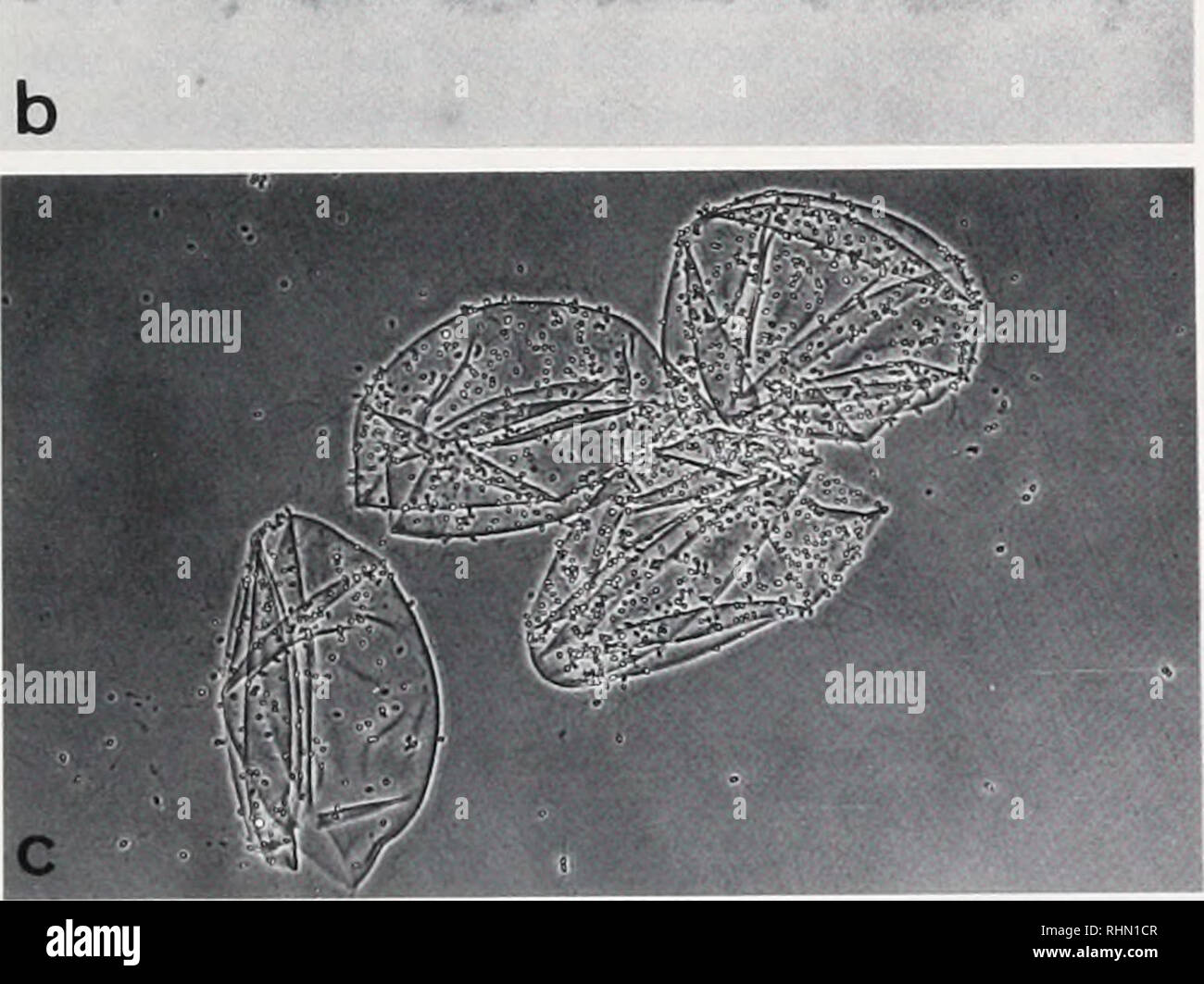 Chorions hi-res stock photography and images - Alamy